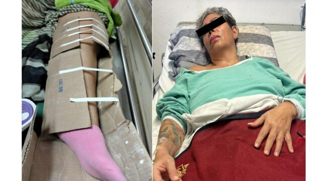 Mujer sufre fractura y le ponen una férula de cartón en la T1